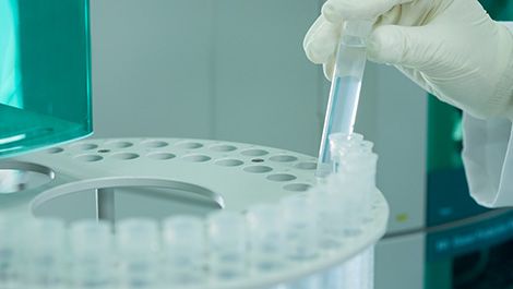 930 Compact IC Flex: routine analysis with superior sensitivity | Metrohm