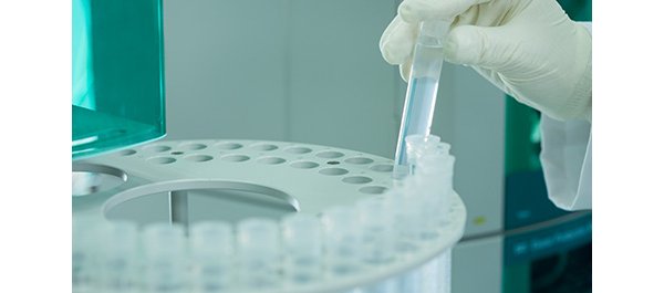 930 Compact IC Flex | Metrohm